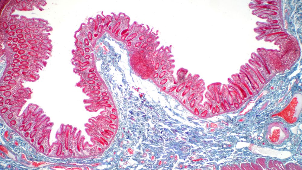 Here's Why You Should Know What Prebiotic and Probiotics are - Net ...